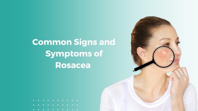 Common Signs and Symptoms of Rosacea - Dr E Dermatology