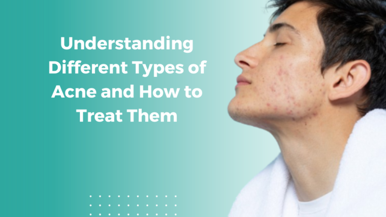 Understanding Different Types of Acne and How to Treat Them